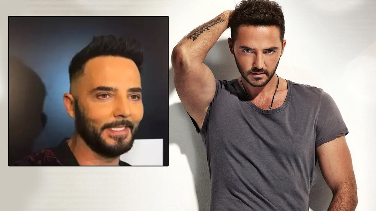 Gökhan Özen'in estetikli hali sosyal medyada olay oldu