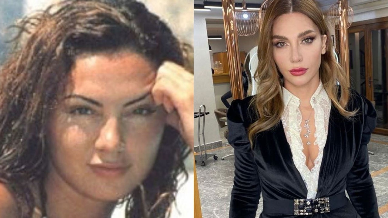 Kızılcık Şerbeti'nin Azra'sı Sema Öztürk'ten 'estetik' tepkisi: Anatomi ...